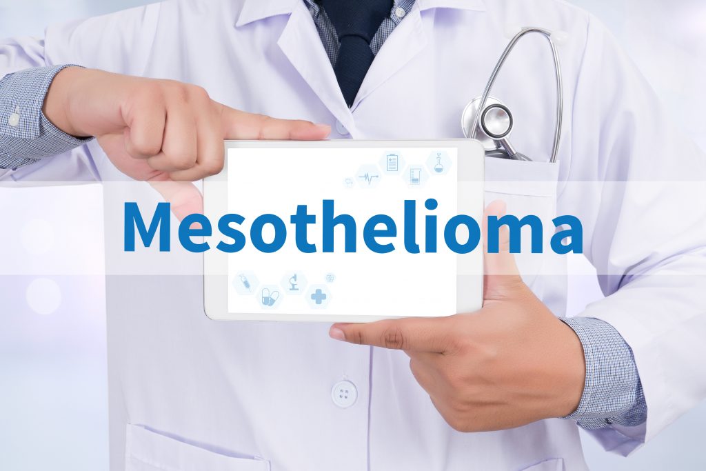 Understanding Mesothelioma Stages Diagnosis And Care